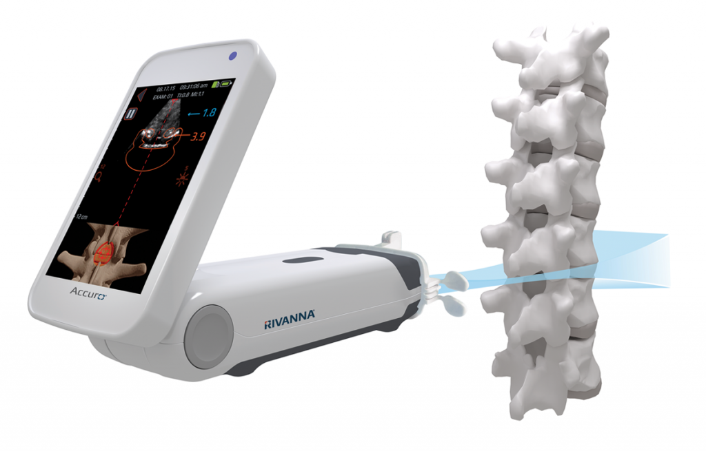 Accuro’s automated spinal navigation technology is clinically proven ...