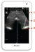 Automatic Epidural Location and Depth | ACCURO | RIVANNA